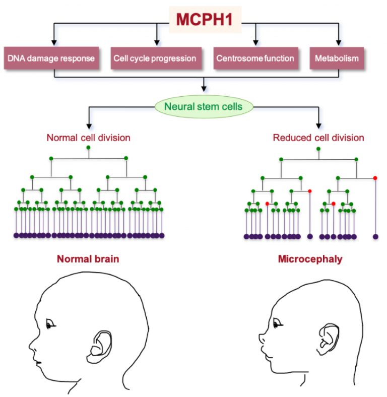 Genetic Mysteries of Microcephaly: The Role of SASS6 Gene - Civilsdaily