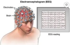 100 years of Electroencephalography (EEG) - Civilsdaily